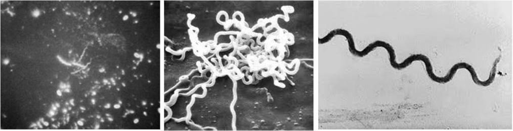 Pinta, Yaws and Bejel (ICDs 103, 102 and 104) | Brian Altonen, MPH, MS